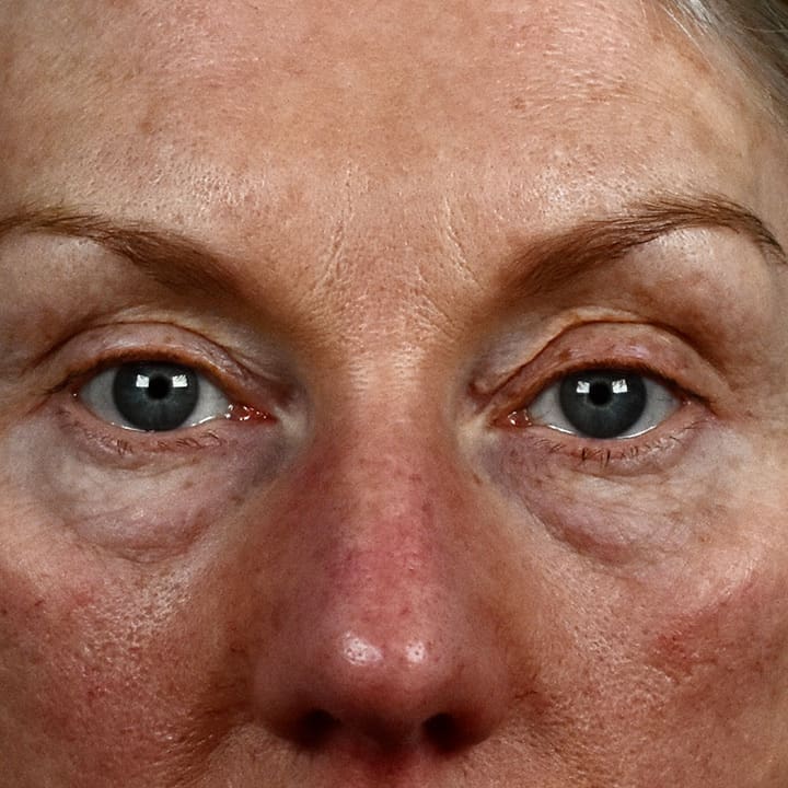 Face Treatments | McKeown Medical Glasgow