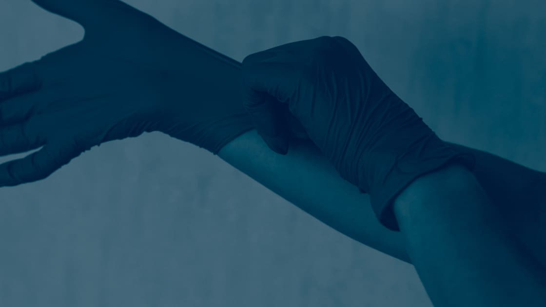 Your guide to radiofrequency ablation (RFA) treatment of varicose veins ... Your guide to radiofrequency ablation (RFA) treatment of varicose veins ...