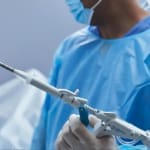 NovaSure® Endometrial Ablation | McKeown Medical Glasgow